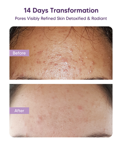 LIQUICK Liquid Mud Mask - Promise Cosmetics